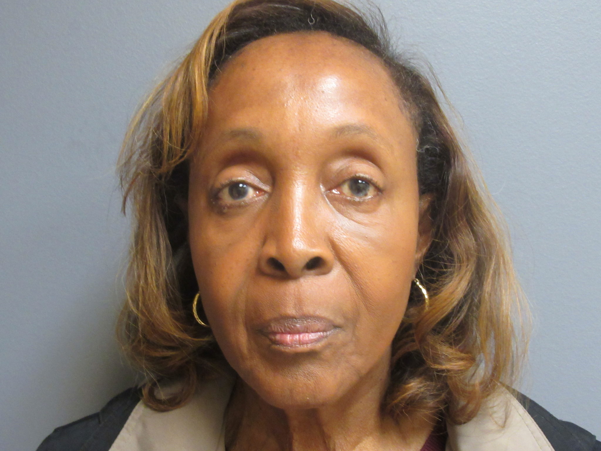 Facial Rejuvenation: Fat Transfer & Brow Lift Results - Aesthetic ...