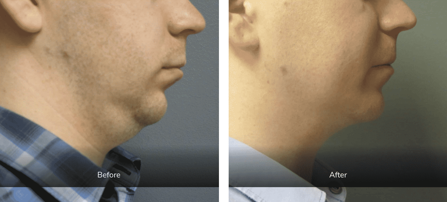 Male Plastic Surgery Michigan - Aesthetic Plastic Surgery & Laser ...